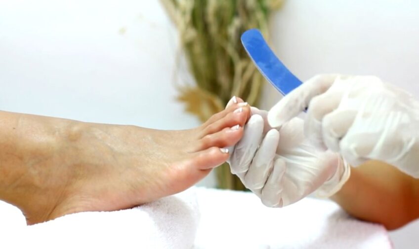 3 Benefits of Probiotics for Nail Fungus: Science-Backed Solutions